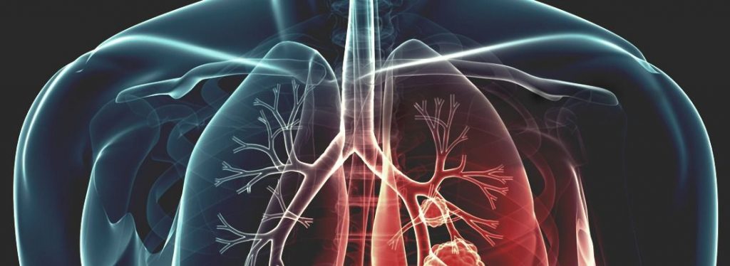 Θωρακοχειρουργικό – Νοσοκομείο Μεταξά